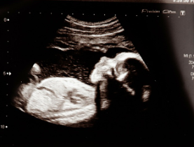 Tout savoir sur le 3ème mois de grossesse – Mamans Pratiques