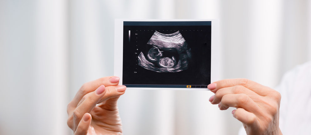 La deuxième échographie : l’échographie morphologique – Mamans Pratiques